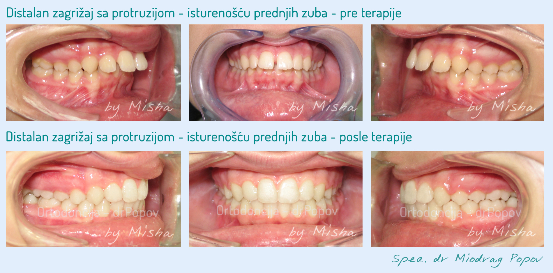 Stomatološka ordinacija Novi Sad – Smile Time » Ortodoncija